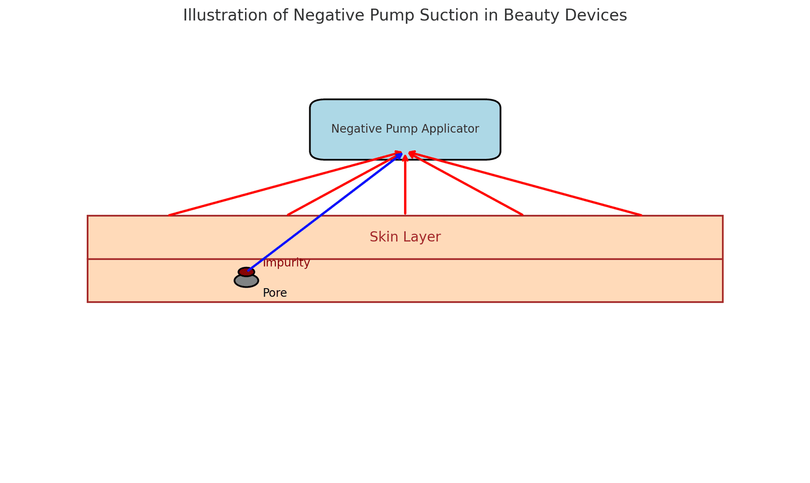 Why Negative Pump Systems Are Essential for Beauty Devices - BODENFLO